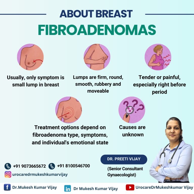 Understanding Breast Fibroadenomas: A Comprehensive Guide – Healcare